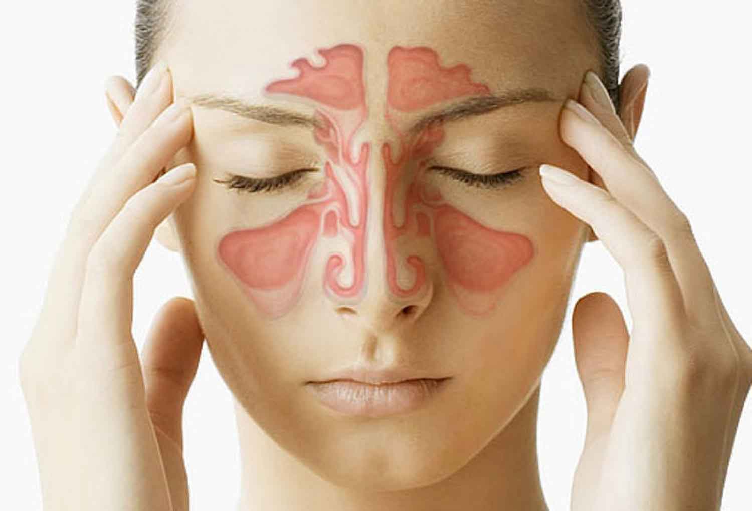 Sinus Treatment In Bangalore - Jindal Naturecure Institute